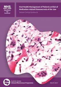 New SDCEP guidance launched | Scottish Dental Clinical Effec